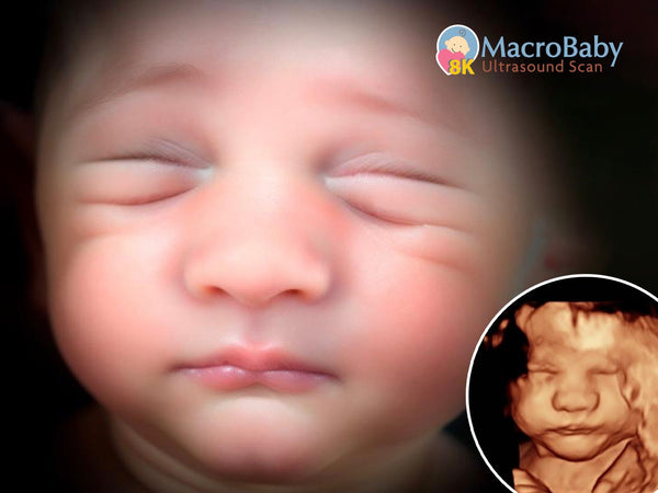 3D Ultrasound & 4D Ultrasound Packages | Orlando, FL | MacroBaby